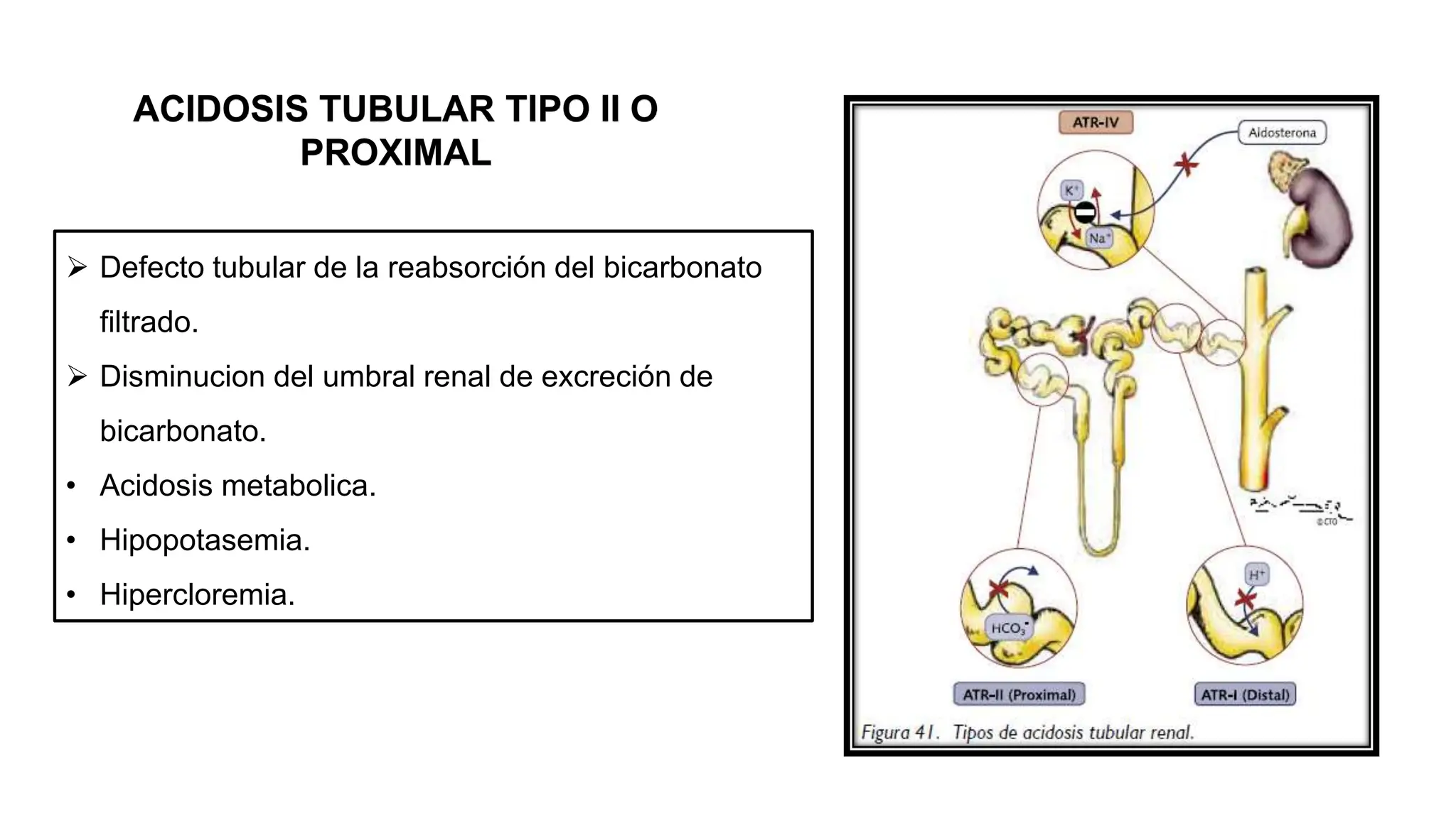 Acidosis tubular reñal en pediatrica medica | PPTX | Medical Health
