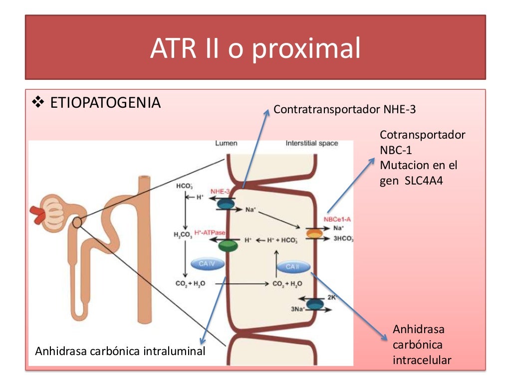 Acidosis tubular renal tipo 2 y 4