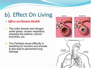 Acid Rain Effects On Humans Lungs