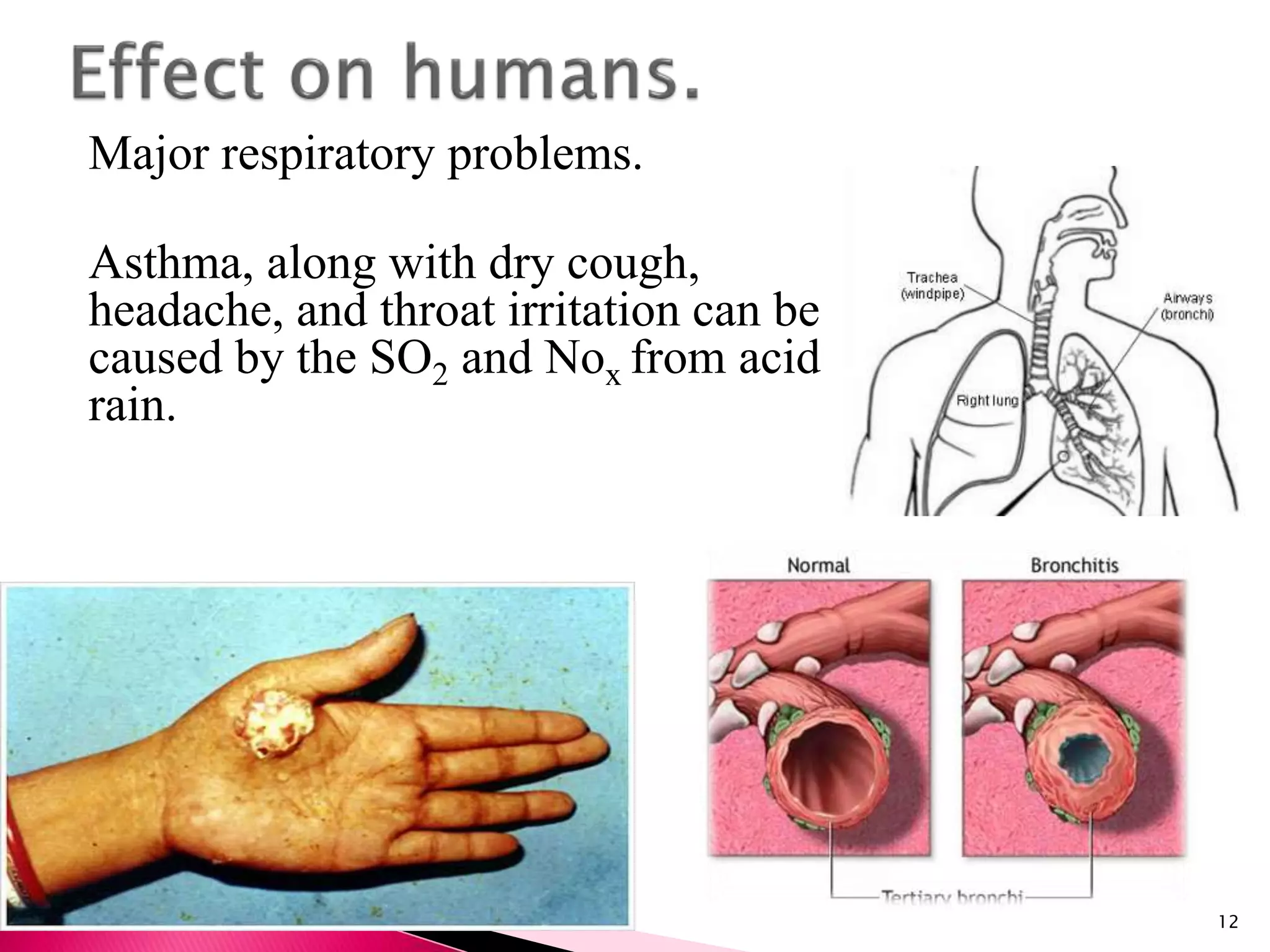 Acid rain and it's impacts on Environment | PPTX