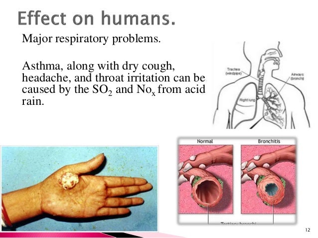 acid rain effects on humans | acid rain facts and information – CGVXUG