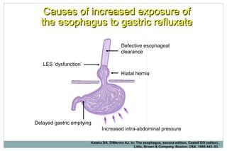 Acid Related Disease_Acid Related Disease | PPT