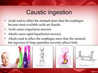 Acids and alkalis f | PPT