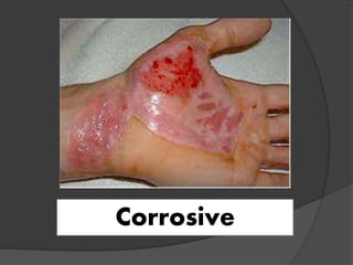 Acidsandbases ppt 2 yr7 | PPTX