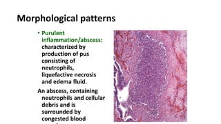 ACUTE INFLAMMATION- CHEMICAL MEDIATORS AND ROLE OF LYMPHATICS AN OVER ...