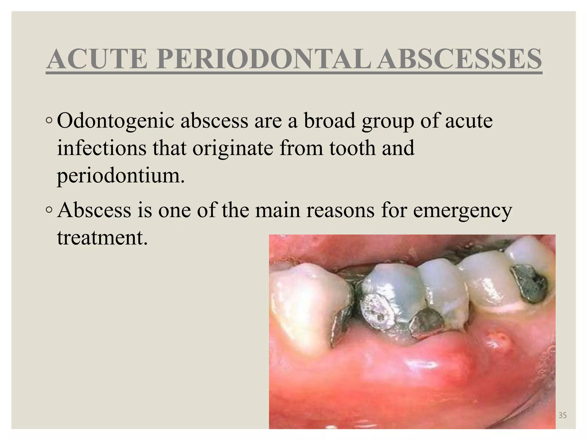 ACUTE GINGIVAL INFECTIONS | PPTX