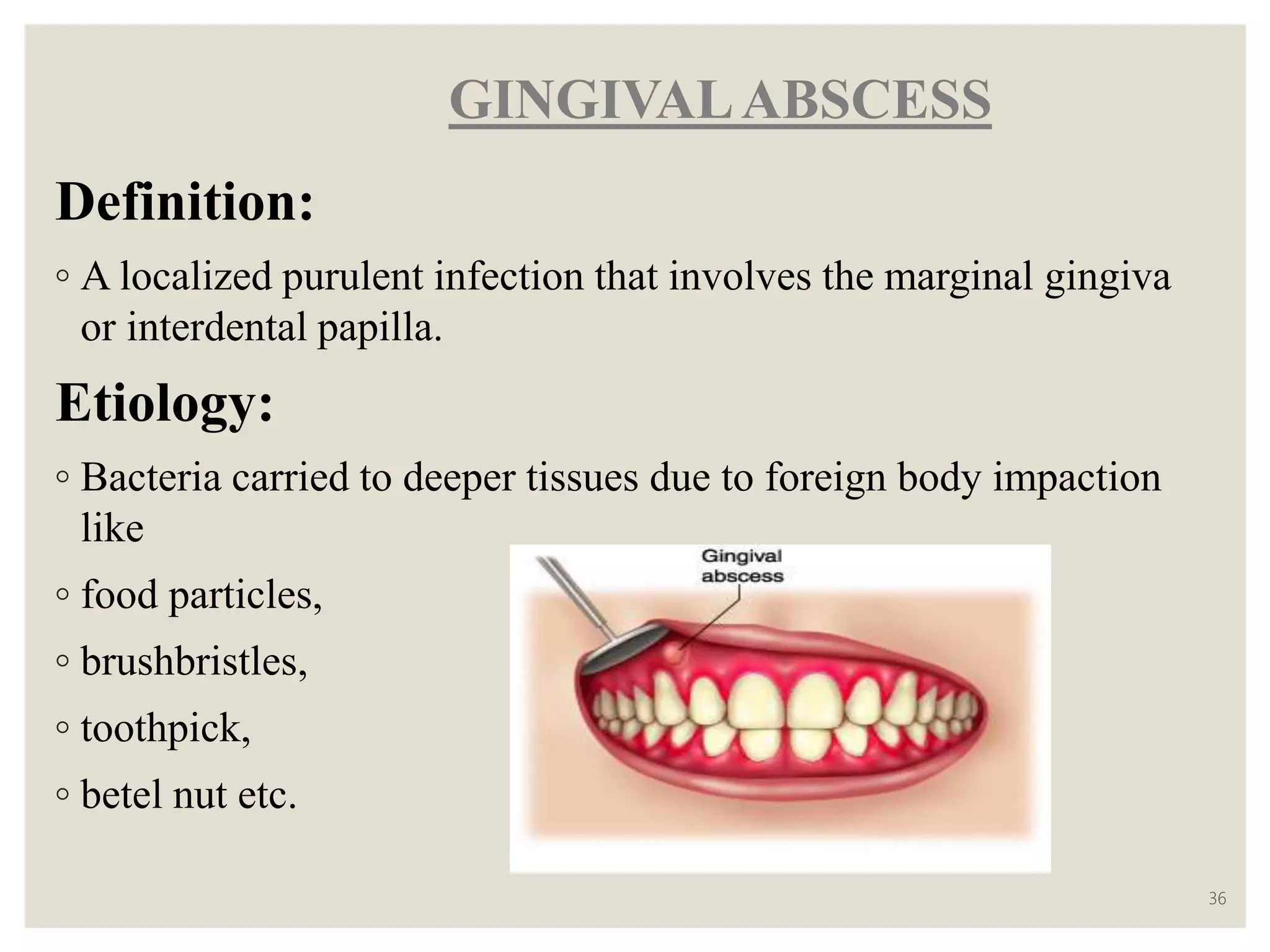 ACUTE GINGIVAL INFECTIONS | PPTX