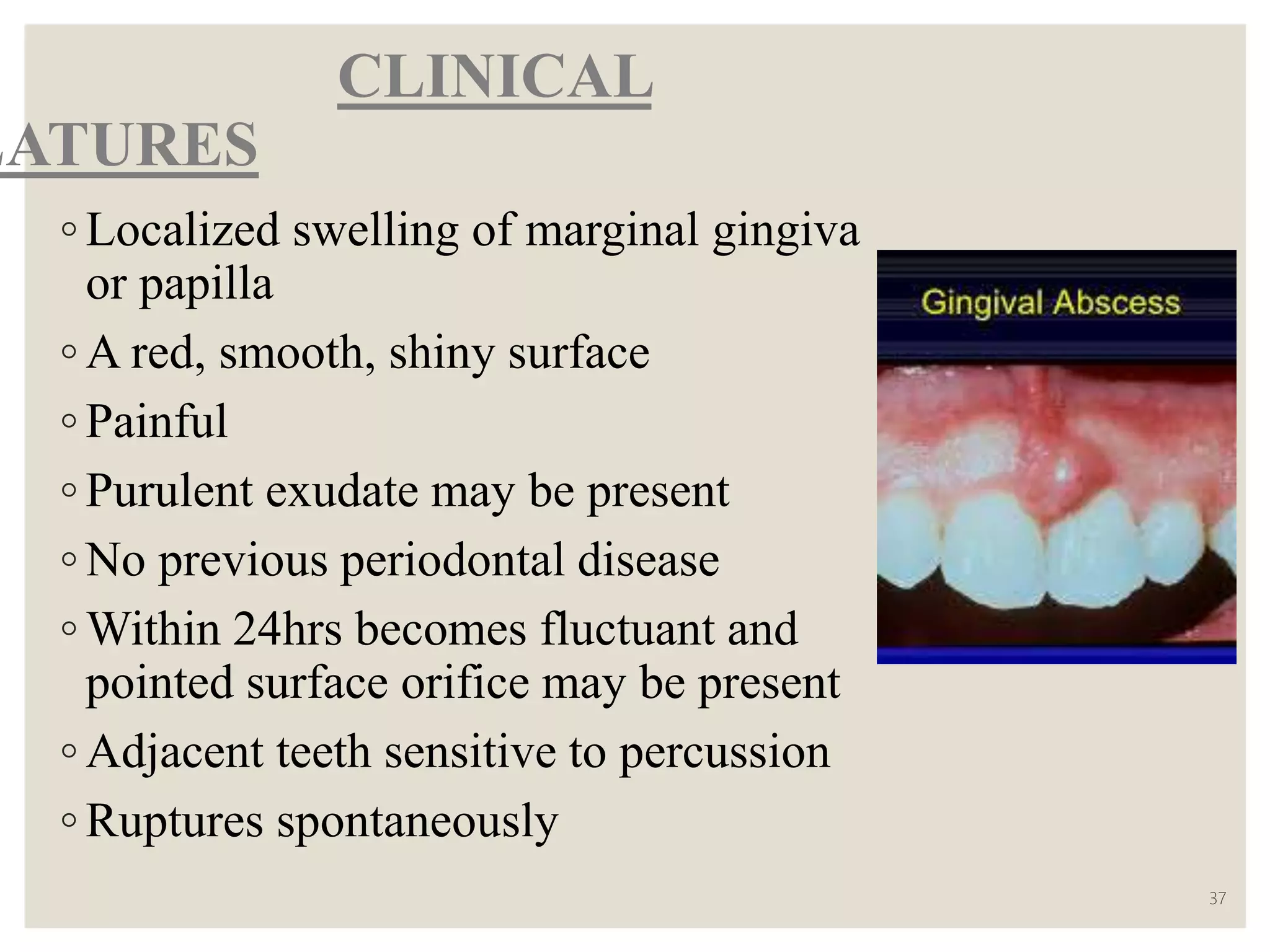 ACUTE GINGIVAL INFECTIONS | PPTX