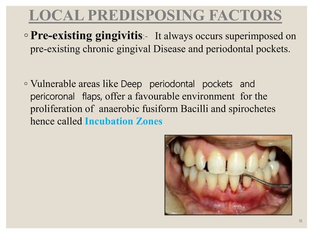 ACUTE GINGIVAL INFECTIONS | PPTX