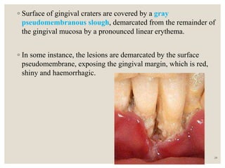 ACUTE GINGIVAL INFECTIONS | PPTX