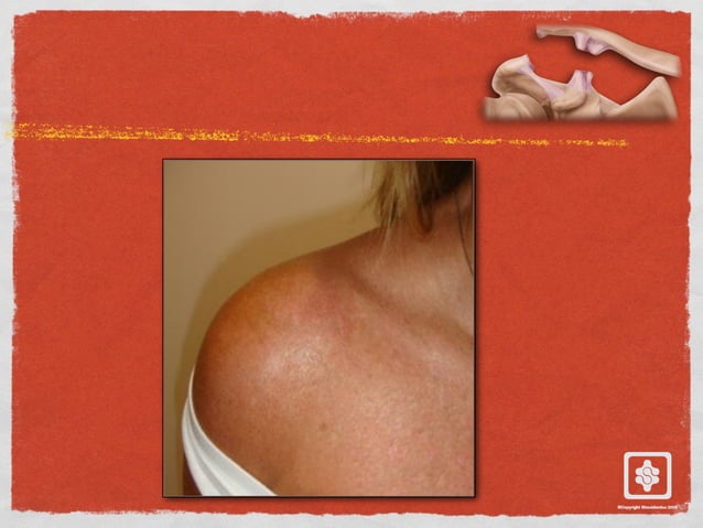 ACJ Disloc Management 2022.pdf