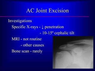 Acj excision watanabe india | PPT