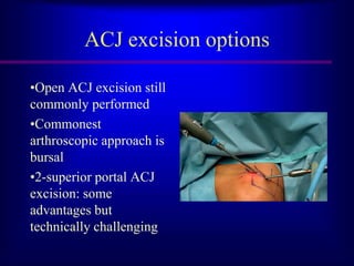 Acj excision watanabe india | PPT
