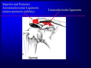 Acj excision watanabe india | PPT