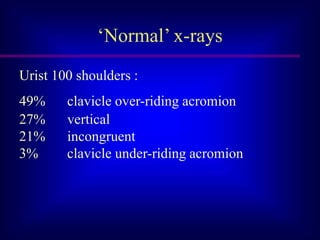 Acj excision watanabe india | PPT