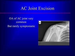 Acj excision watanabe india | PPTX