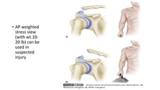 ACROMIOCLAVICULAR JOINT INJURY | PPTX