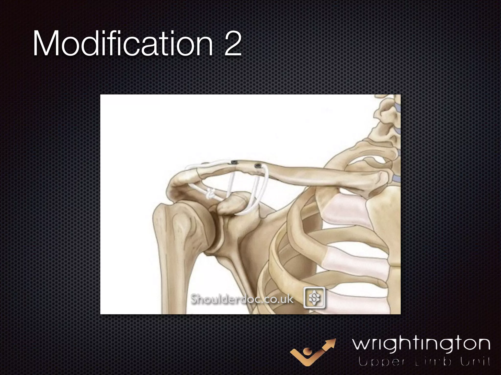 ACJ injury Myths Debunked | PDF | Death, Injury, or Military Conflict | Sensitive Topics