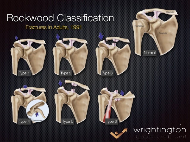 ACJ injury Myths Debunked