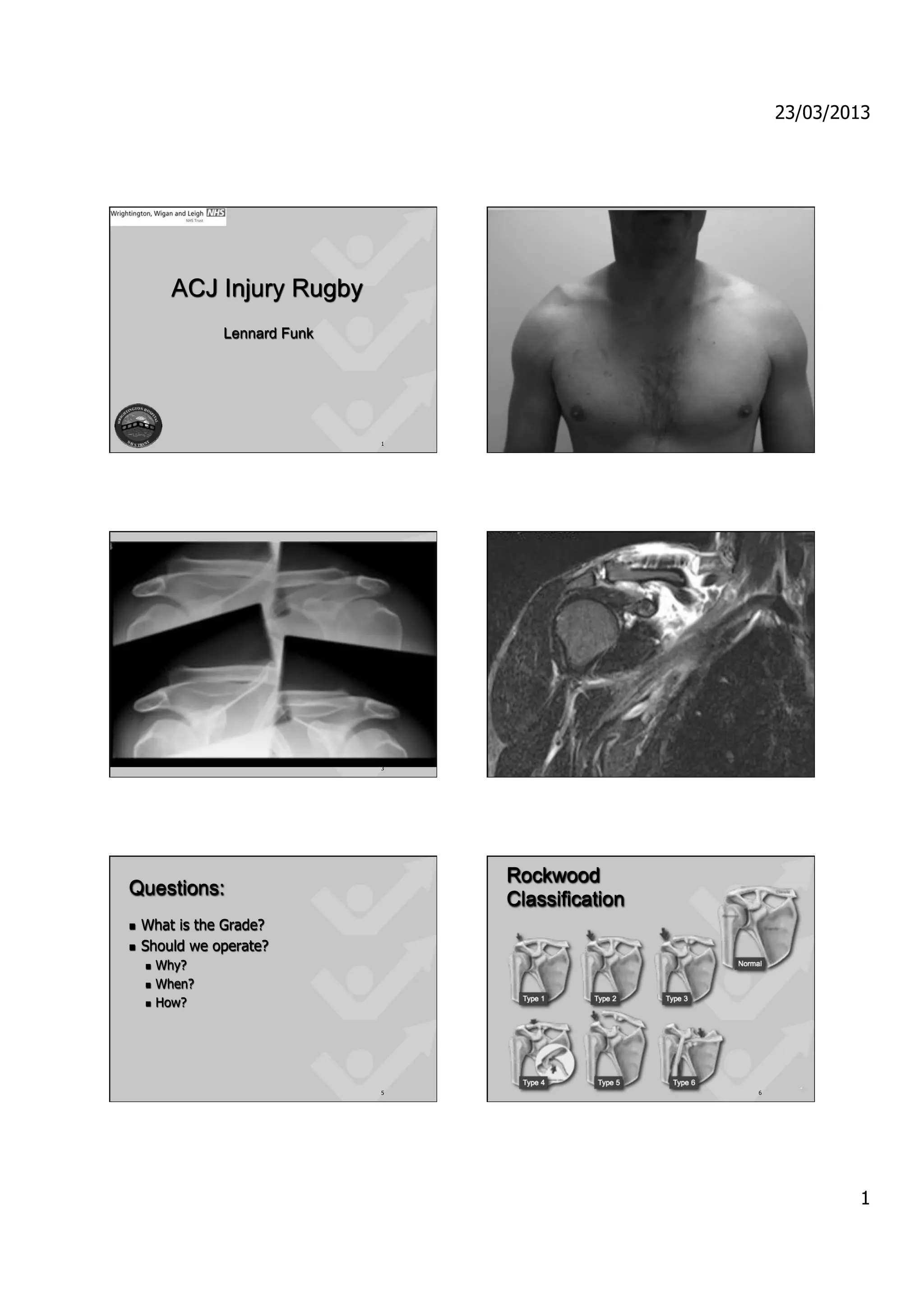 Acj injury rugby | PDF | Physical Therapy | Wellness