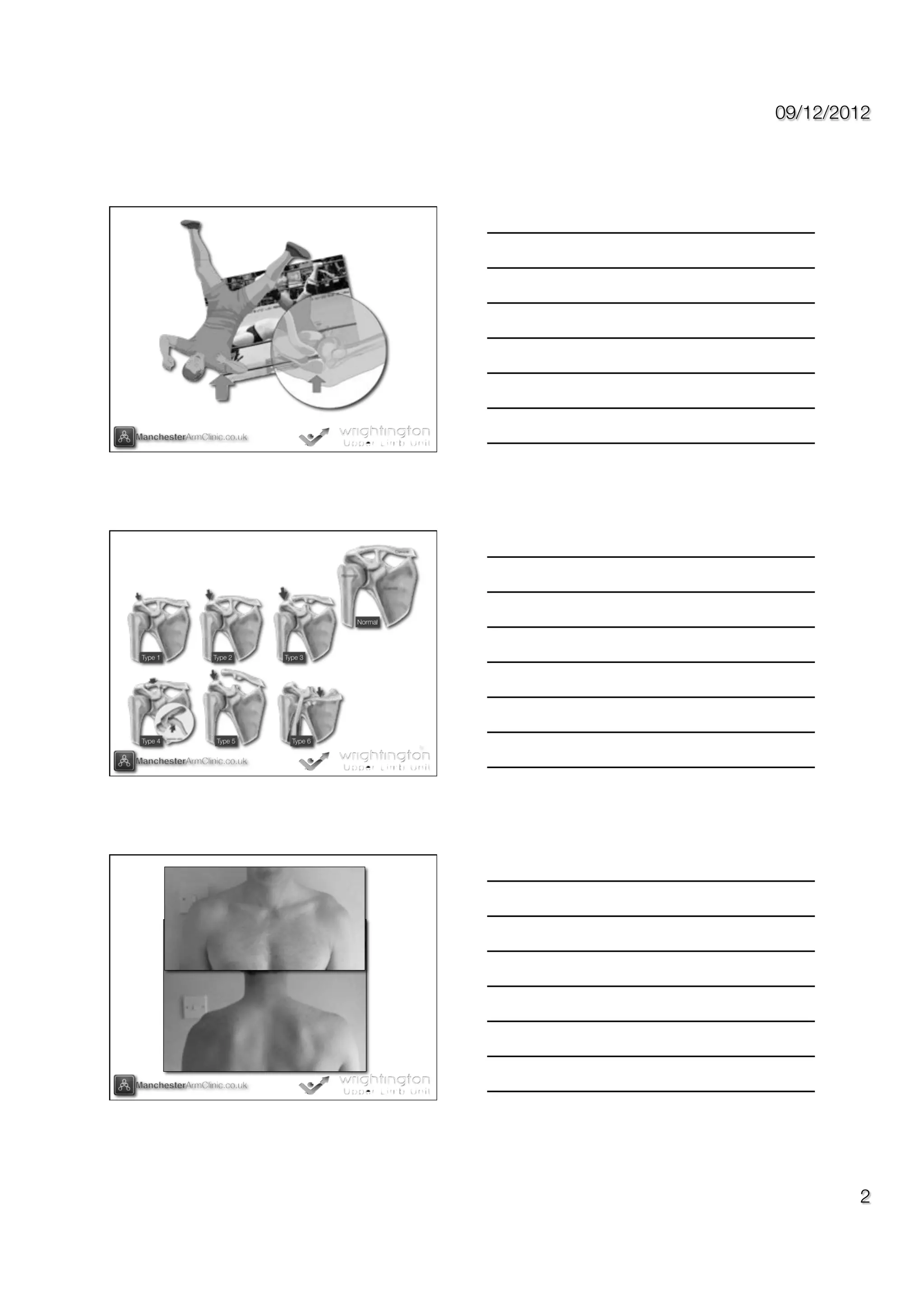 Acj instability mac 2012 | PDF