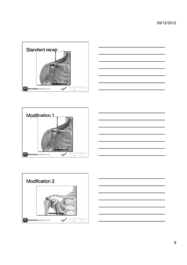 Acj instability mac 2012 | PDF