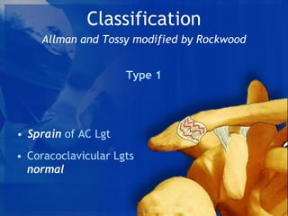 Ac joint | PPTX
