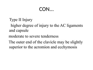 AC JOINT injury and management of principle | PPTX