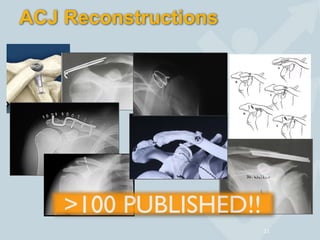 ACJ revision surgery for failed reconstructions and excisions | PDF
