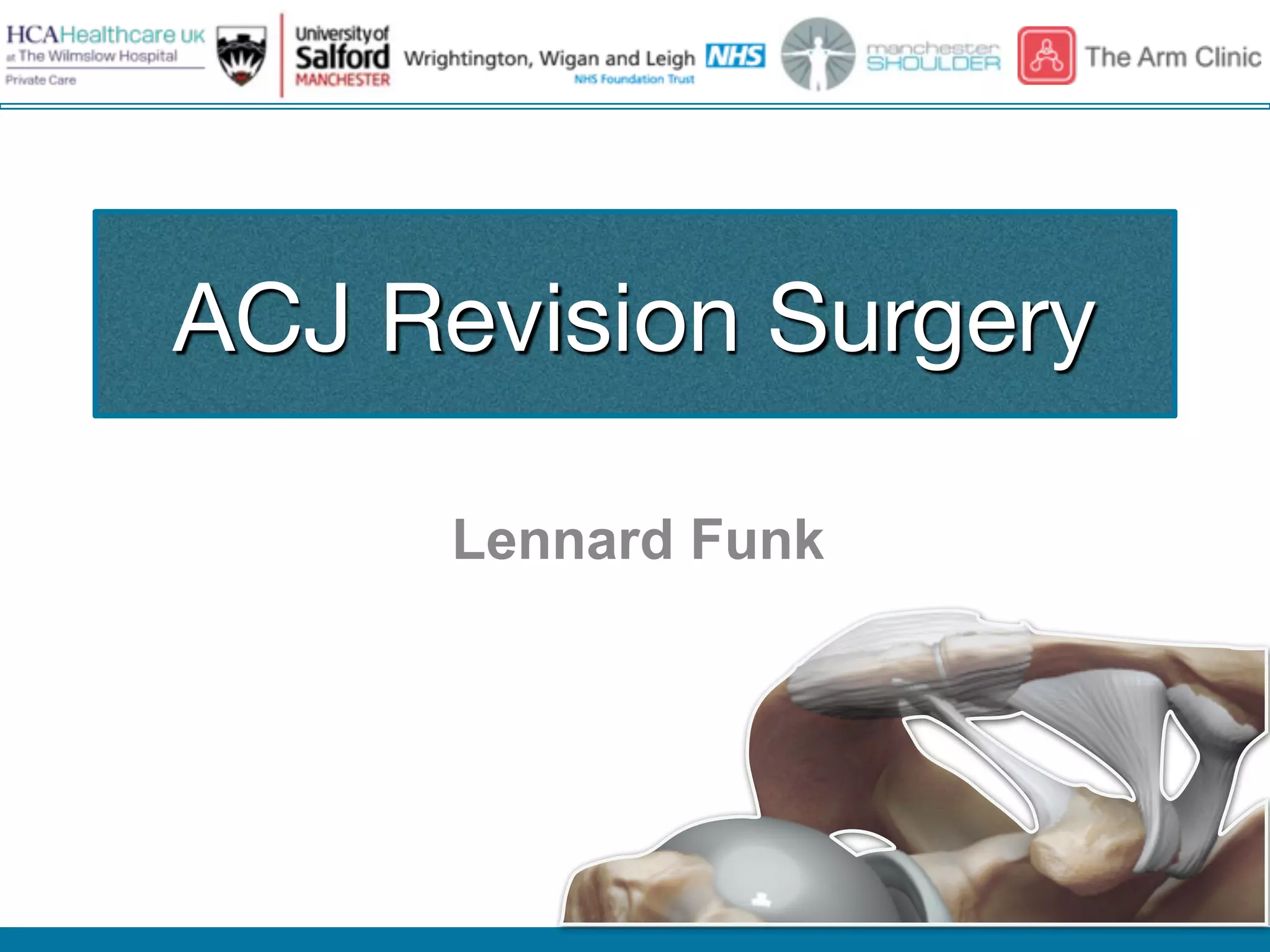 ACJ revision surgery 2017 | PPT