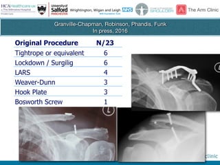 ACJ revision surgery 2017 | PPT