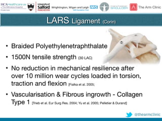 ACJ revision surgery 2017 | PPT