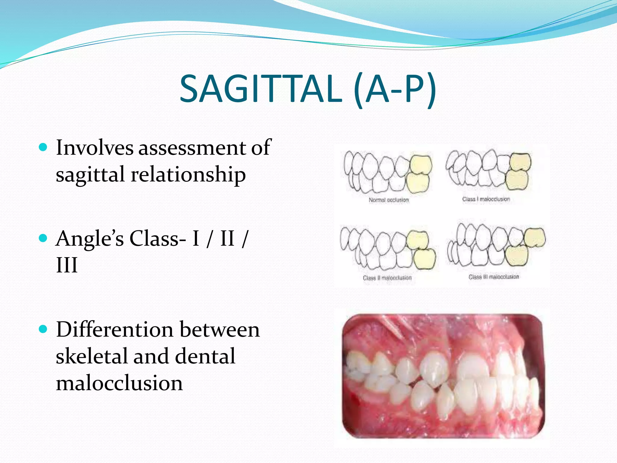 Ackerman & proffit classification of malocclusion | PPTX