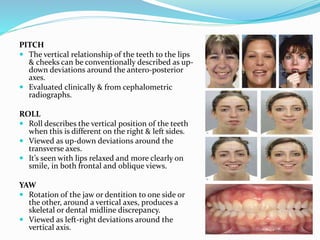 Ackerman & proffit classification of malocclusion | PPTX