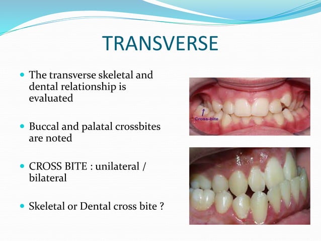 Ackerman & proffit classification of malocclusion | PPTX