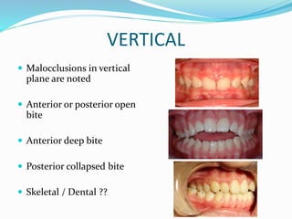 Ackerman & proffit classification of malocclusion | PPTX