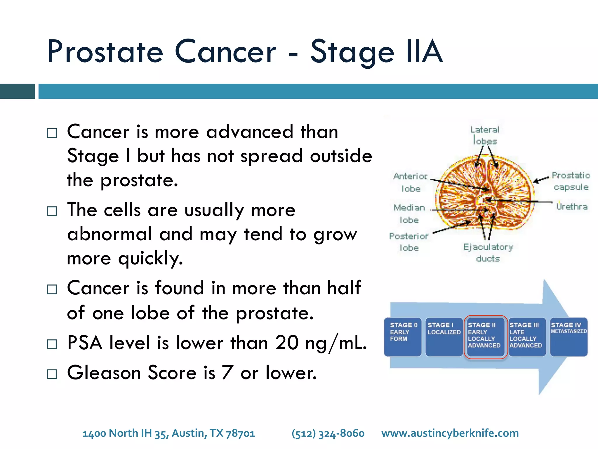 Stages of Prostate Cancer | PDF