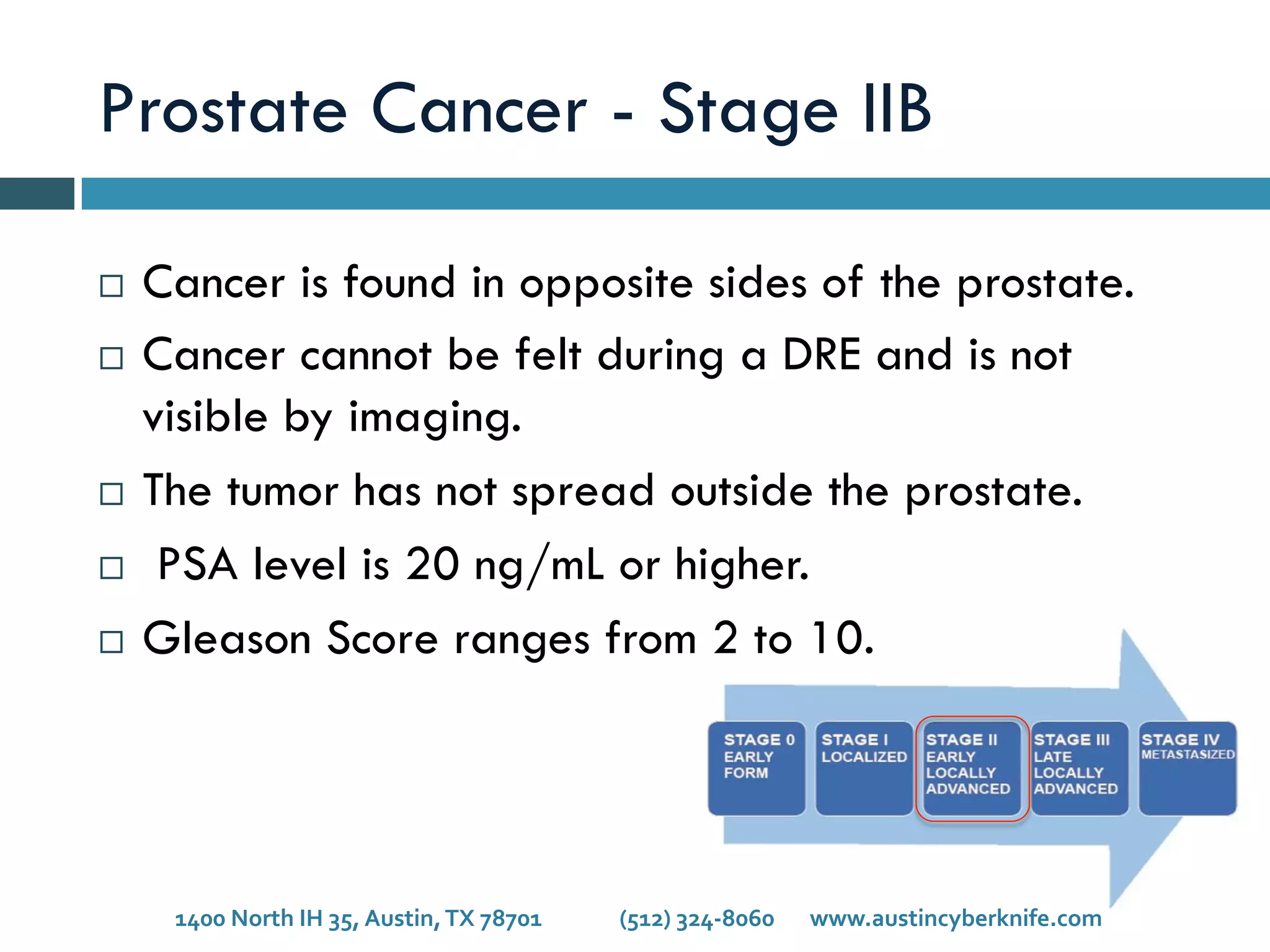 Stages of Prostate Cancer | PDF