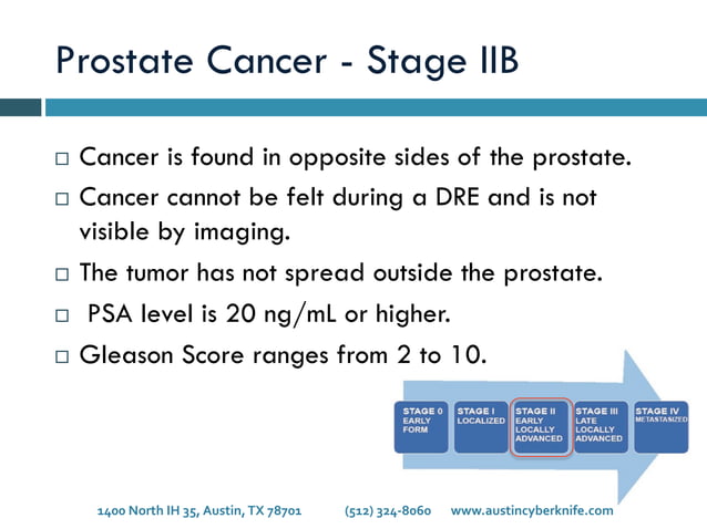 Stages Of Prostate Cancer