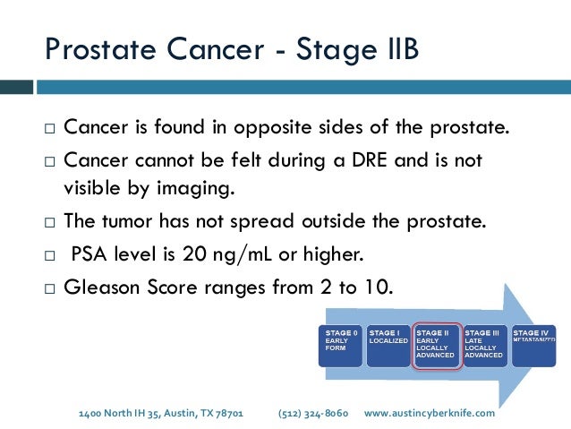 Stages of Prostate Cancer