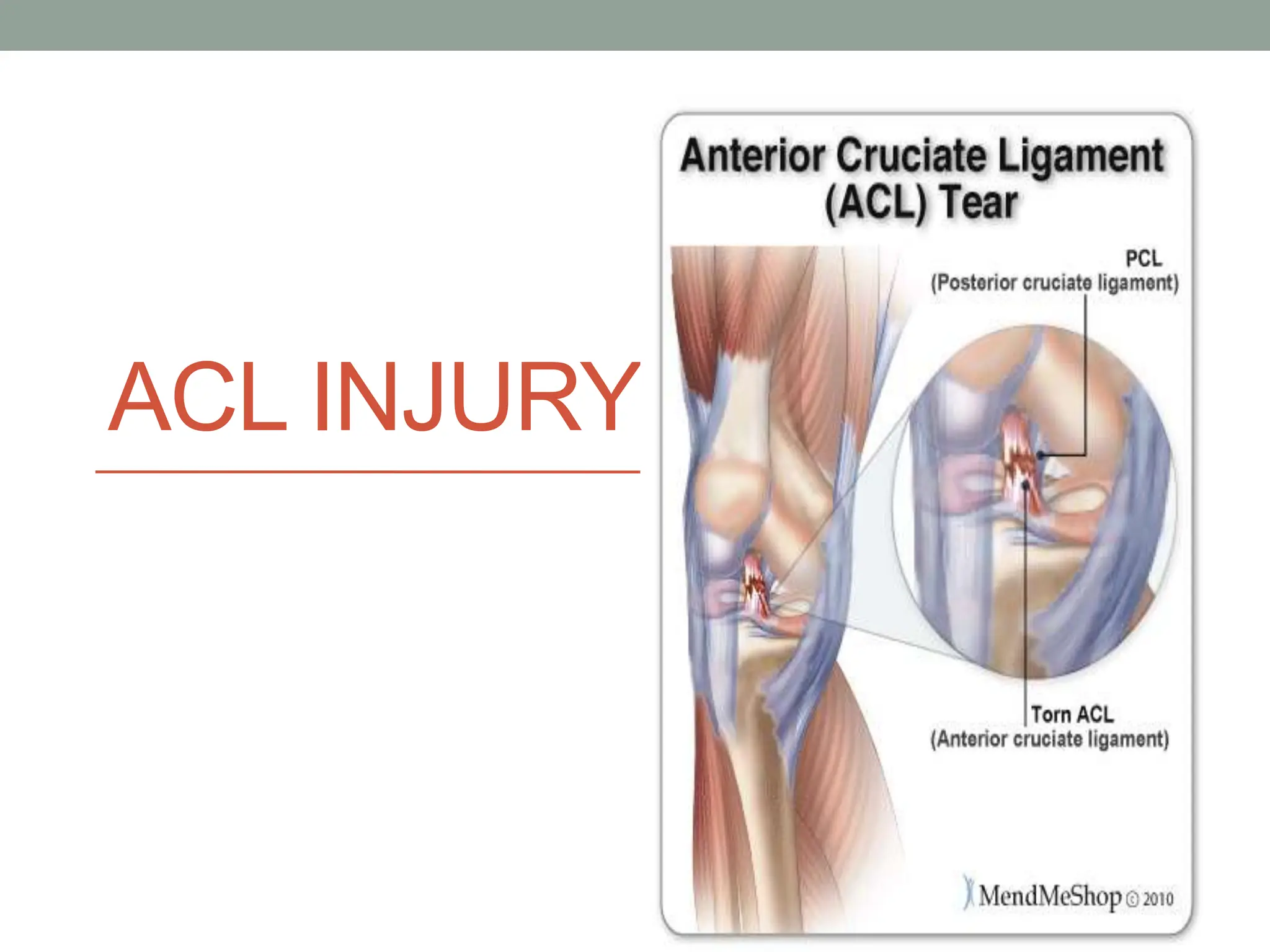 ACL.injury.final year.pptx