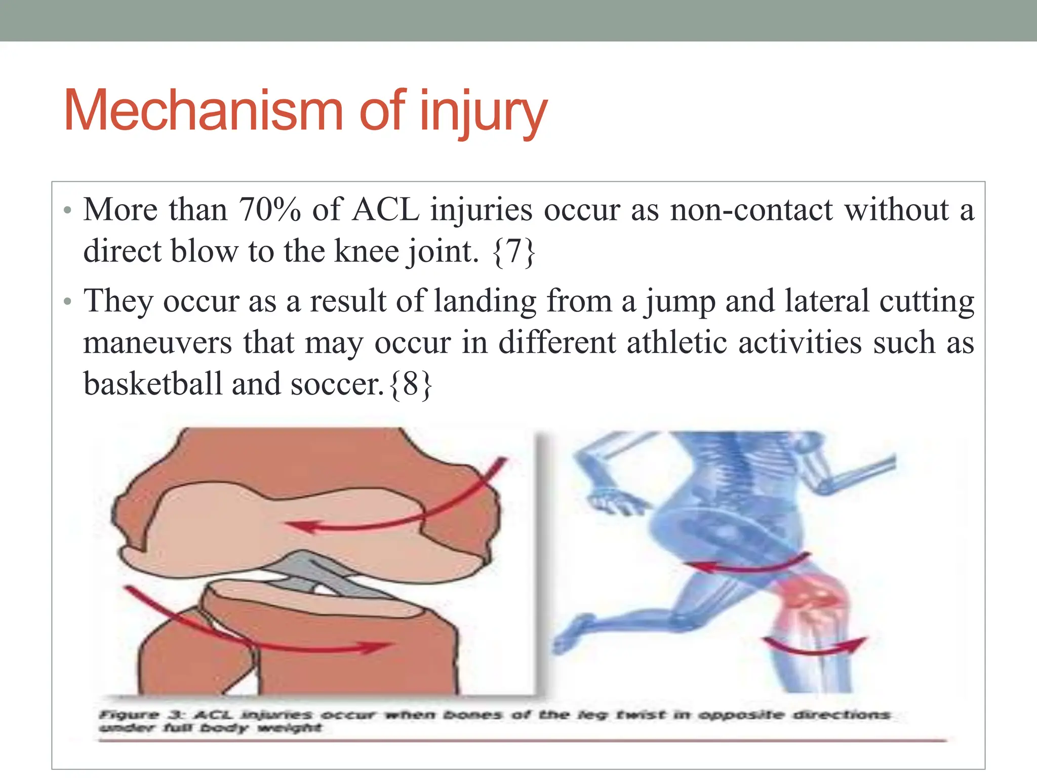 ACL.injury.final year.pptx