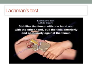 ACL.injury.final year.pptx