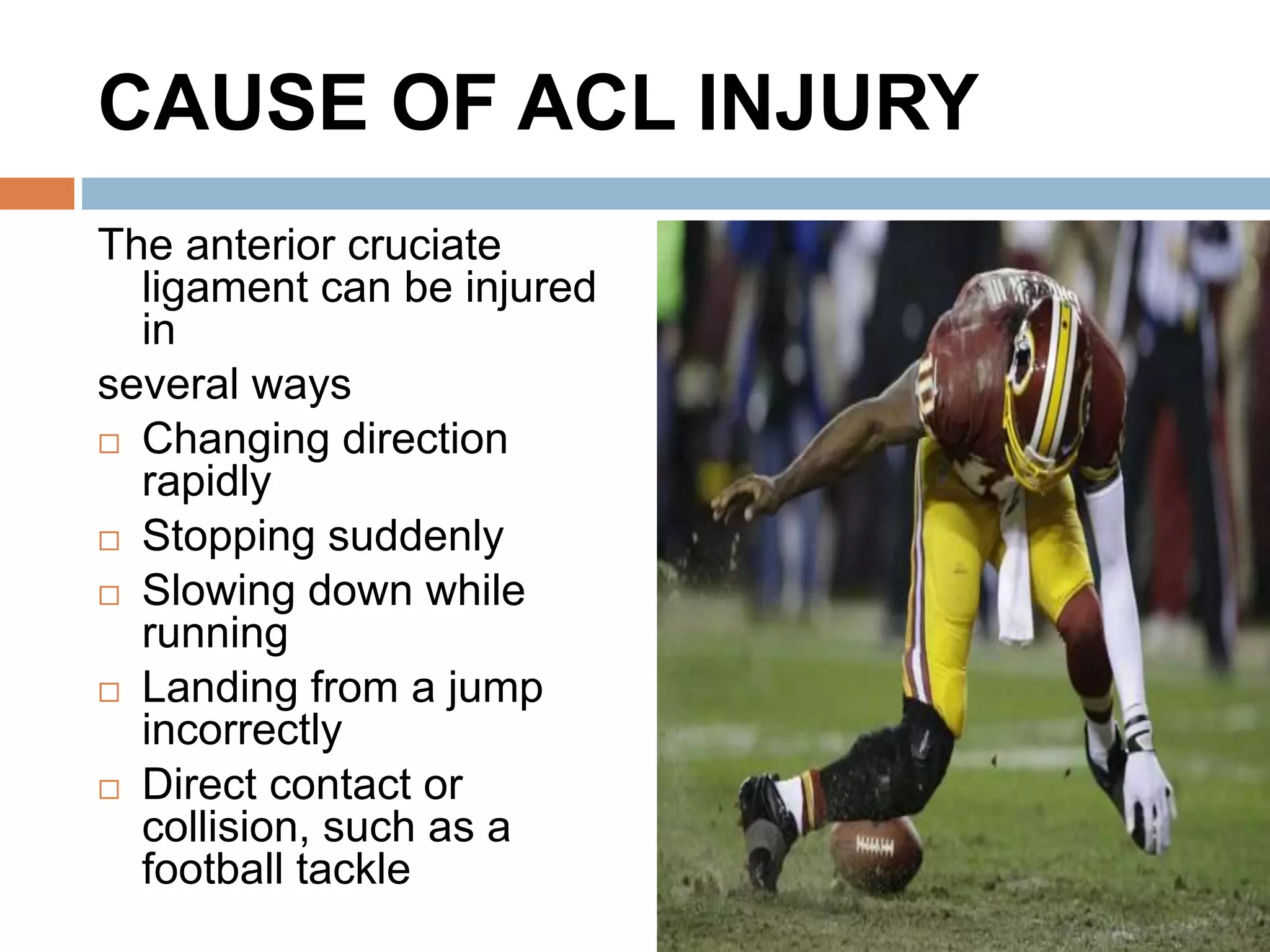 Anterior cruciate ligament-Injury & management | PPTX