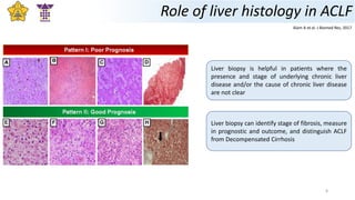 Aclf fixed | PPTX | Blood Disorders | Diseases and Conditions