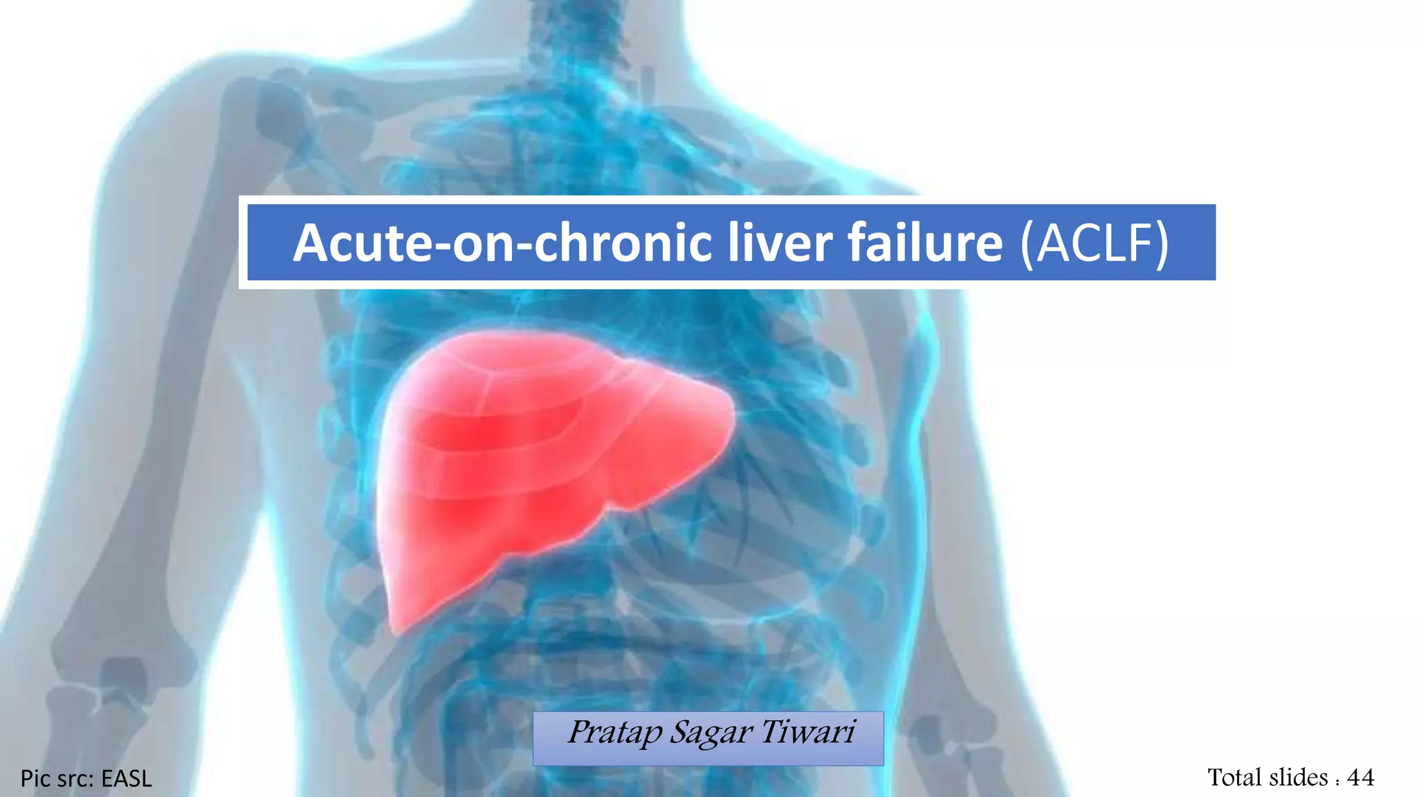 Acute on Chronic Liver Failure (ACLF) | PPTX