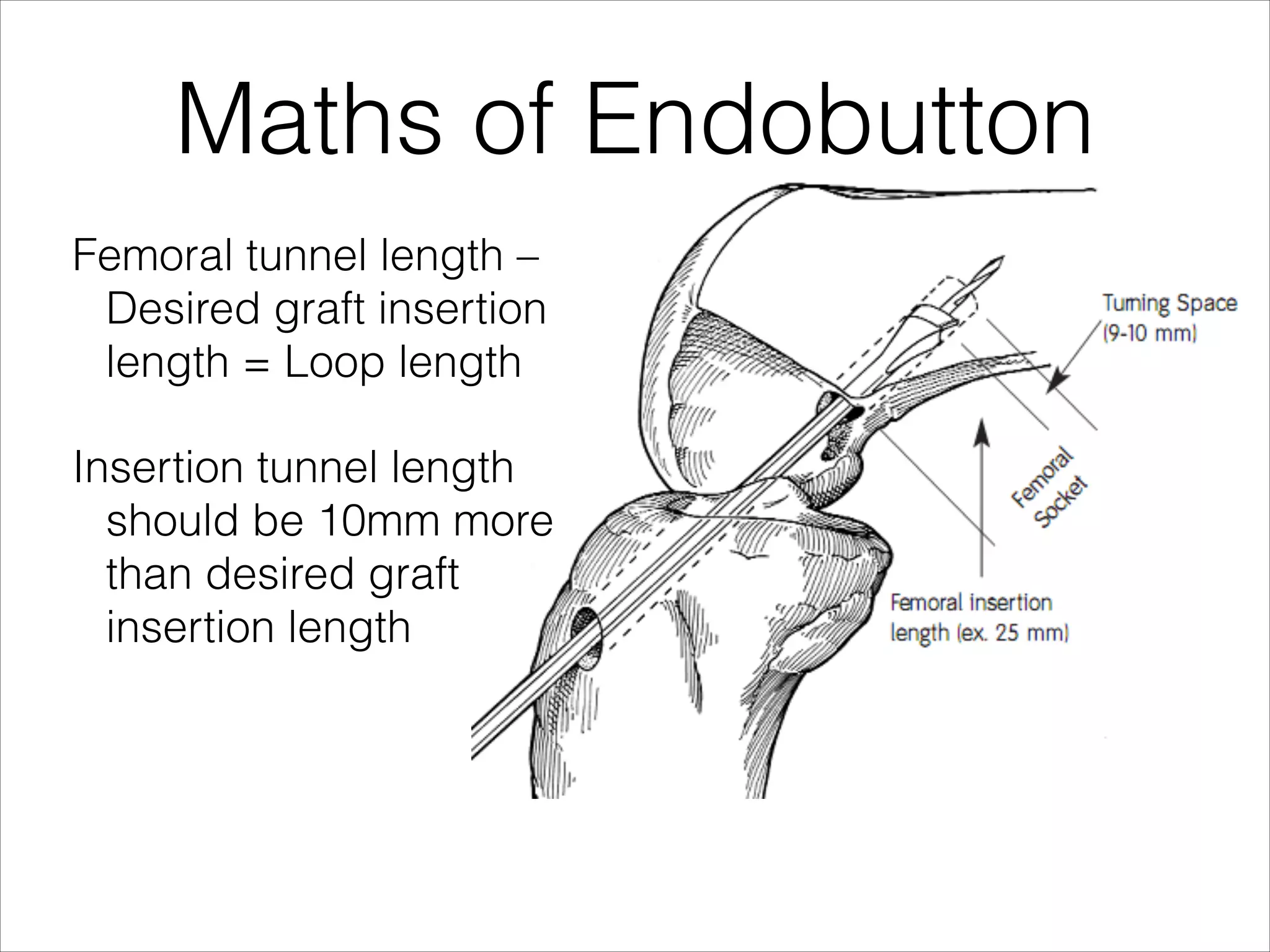 Acl graft fixation options | PDF