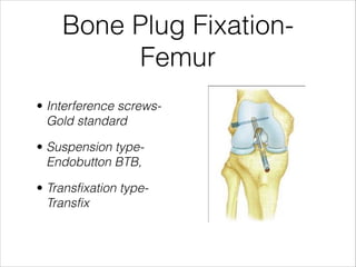 Acl graft fixation options | PDF