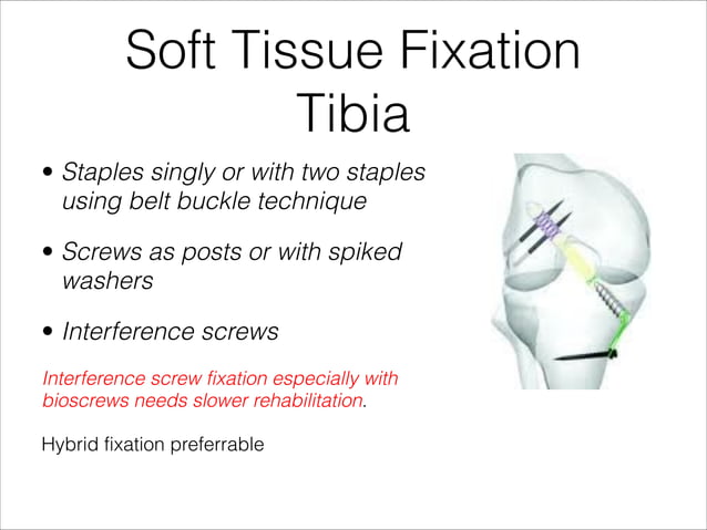 Acl graft fixation options | PDF