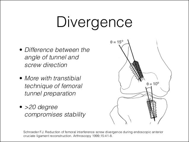 Acl graft fixation options